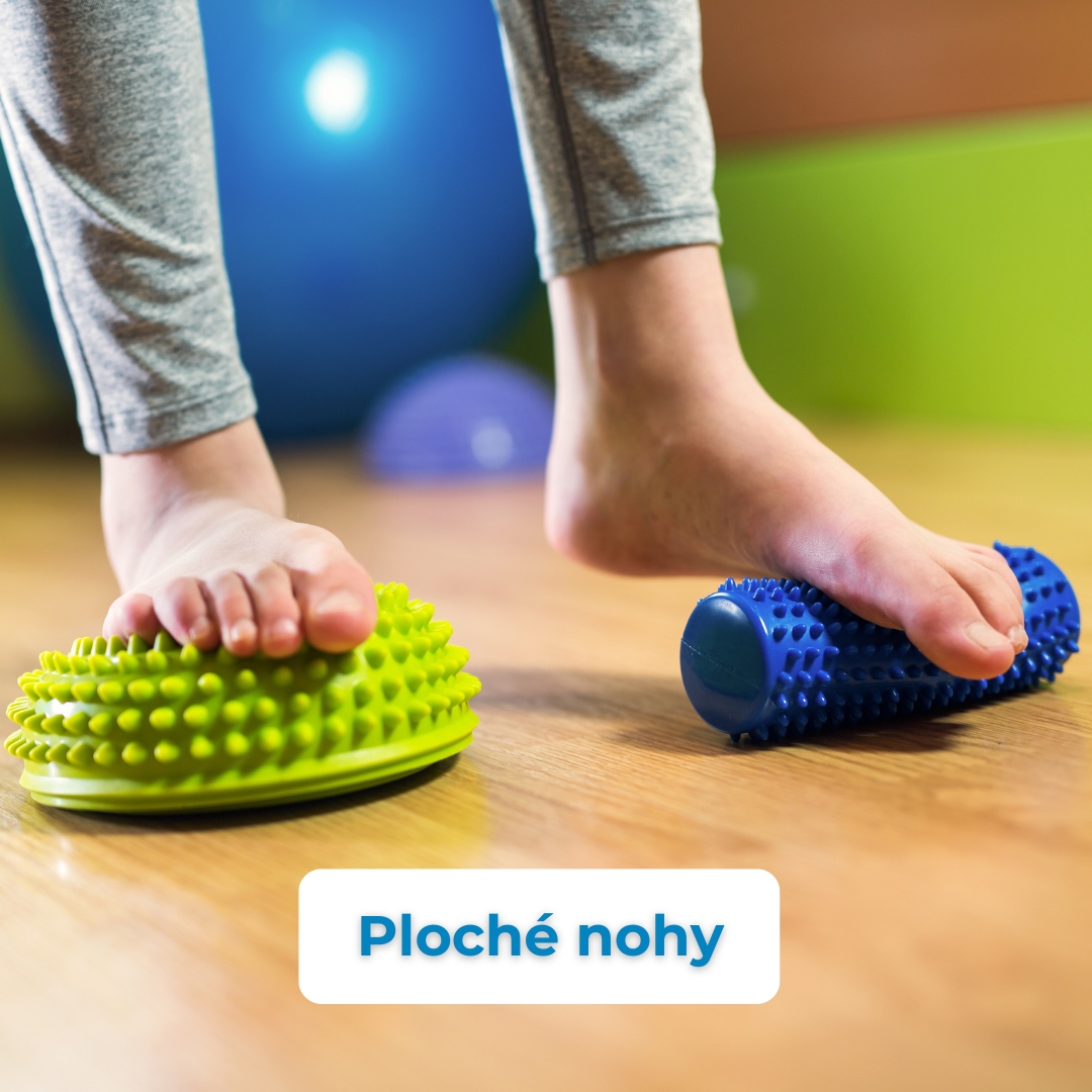 Ploché nohy: Proč jsou problém a jak se s nimi vypořádat? | Aktuálně ...